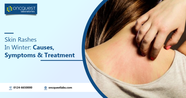 Fingers Swelling in Winter: Causes, Symptoms and Treatment